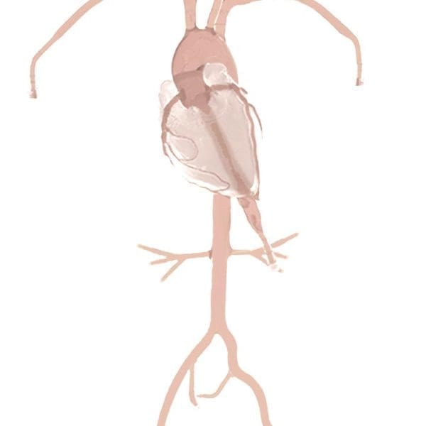 Coronary Aorta Model with Coronary Heart Base – United Biologics